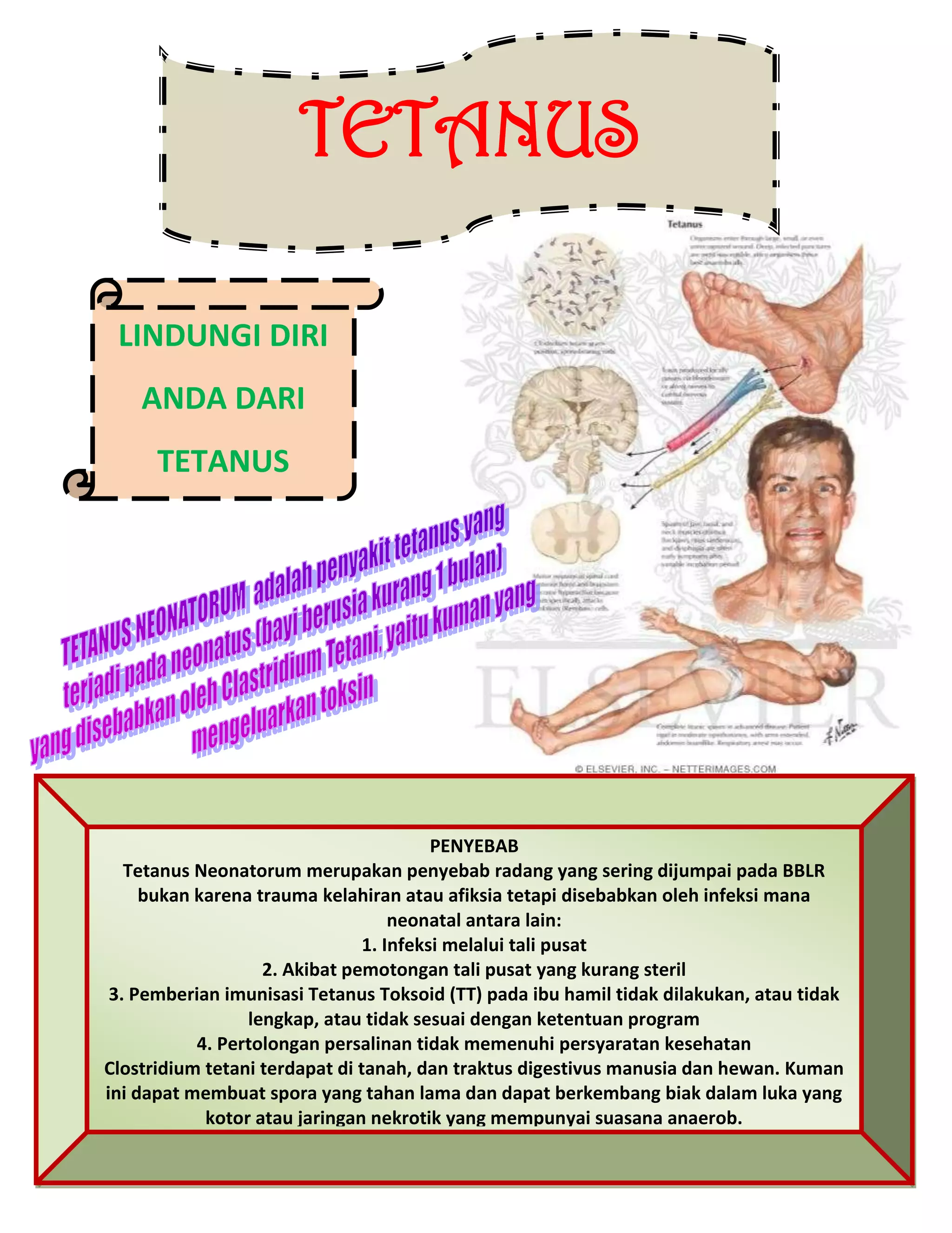 Poster tetanus | DOCX