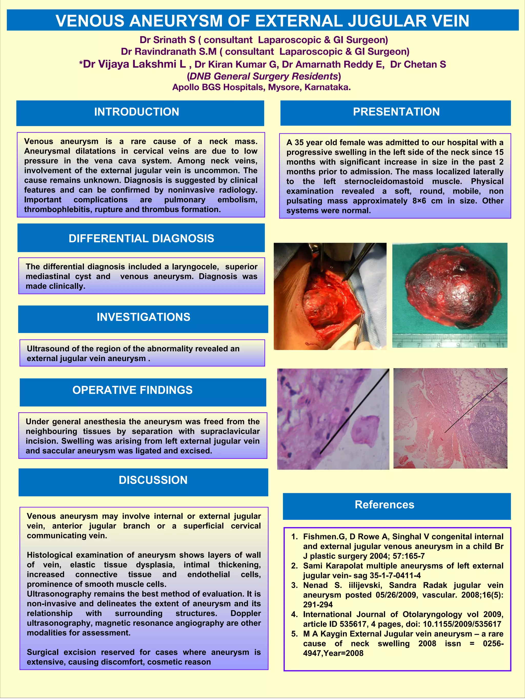 Poster on Venous Aneurysm- Dr. Vijayalakshmi | PDF
