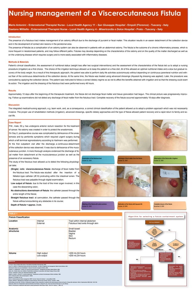 Nursing management of a viscerocutaneous fistula | PDF
