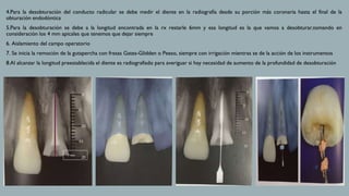 Postes e incrustaciones en odontologia.pptx