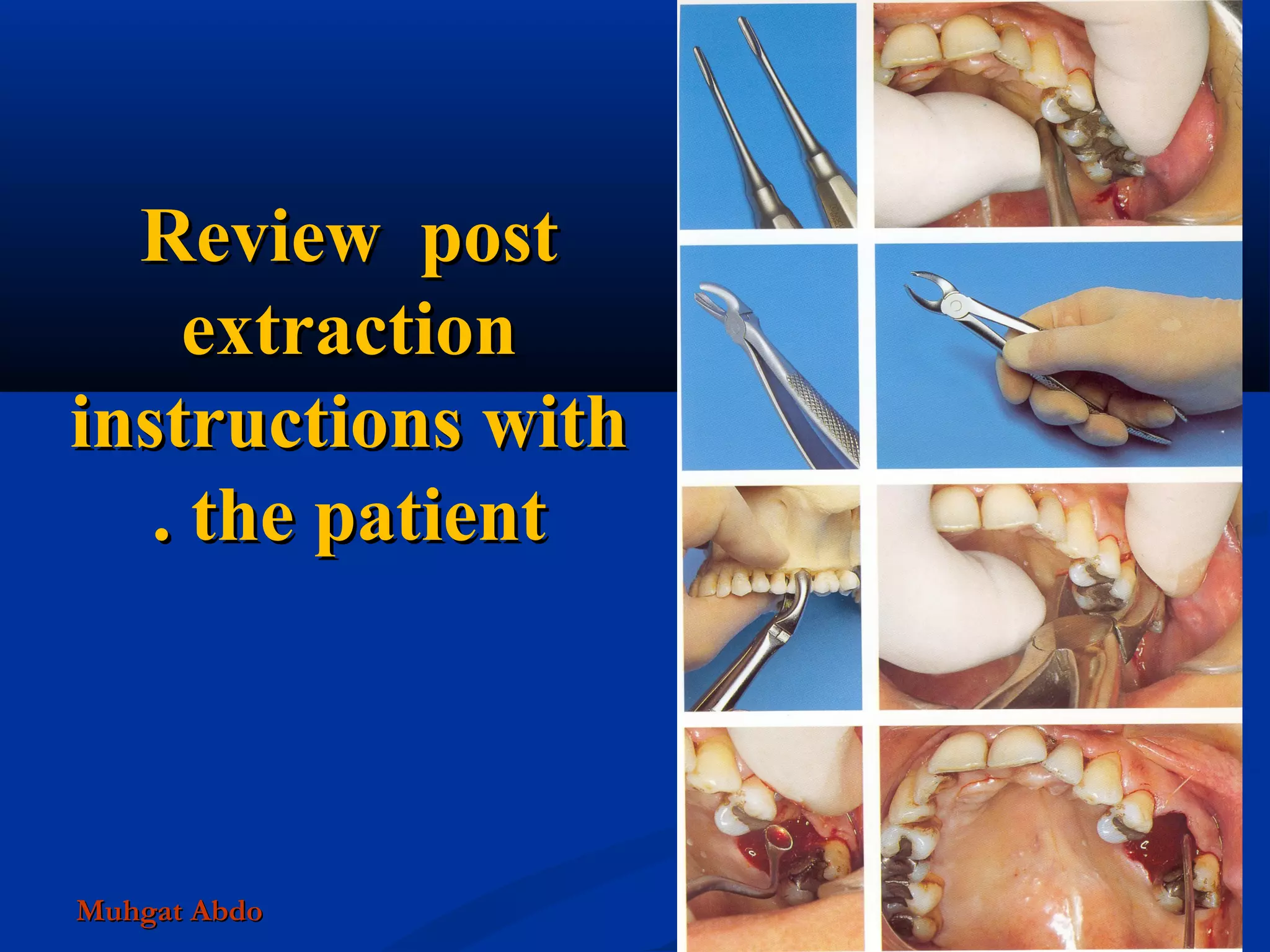 Post extraction care | PPT