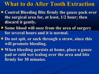 Post extraction care | PPT