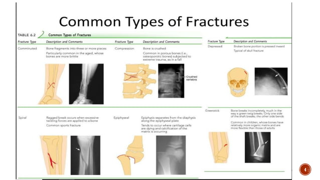 Post fracture rehab for all student.pptx