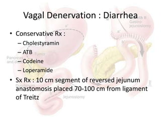 Post Gastrectomy Syndrome | PPTX