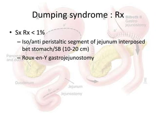 Post Gastrectomy Syndrome | PPTX