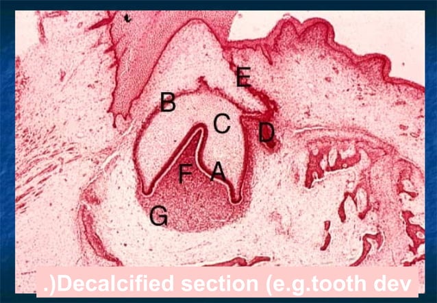 Postgrad. 2013 | PPT