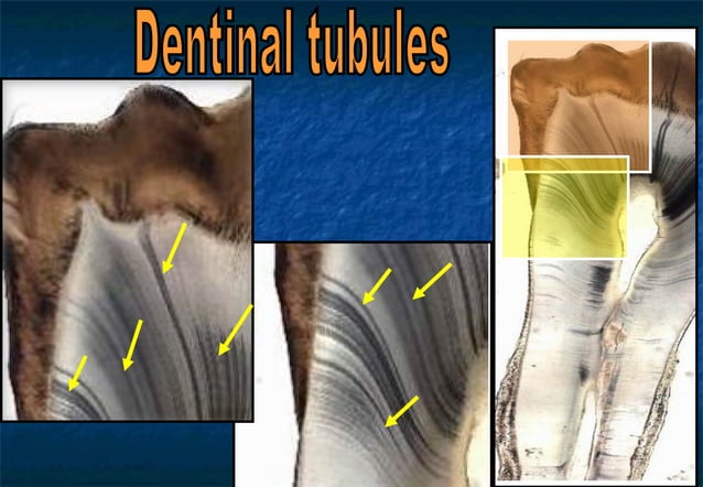 Postgrad. 2013 | PPT