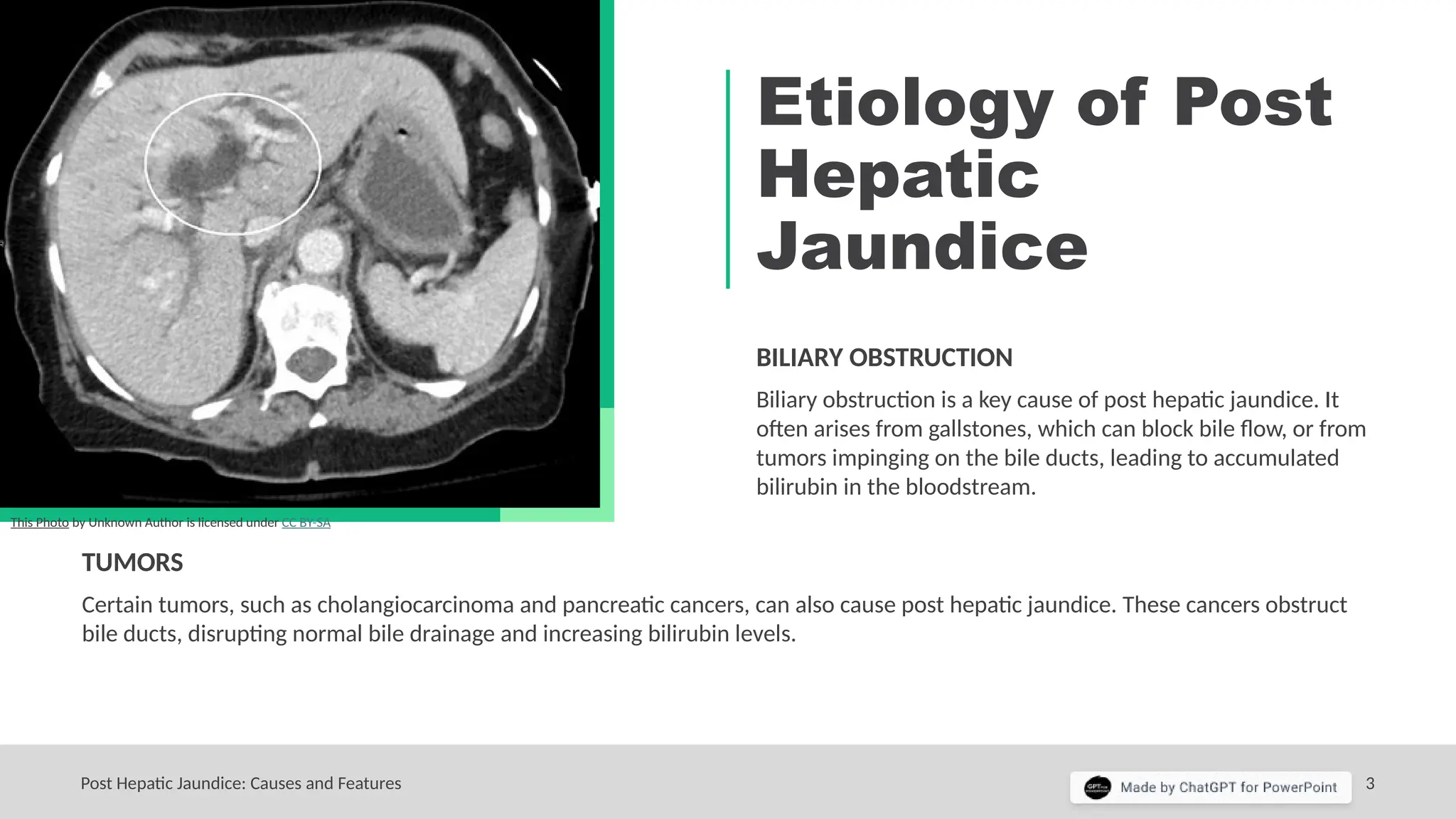 Post Hepatic Jaundice-causes and features | PPTX
