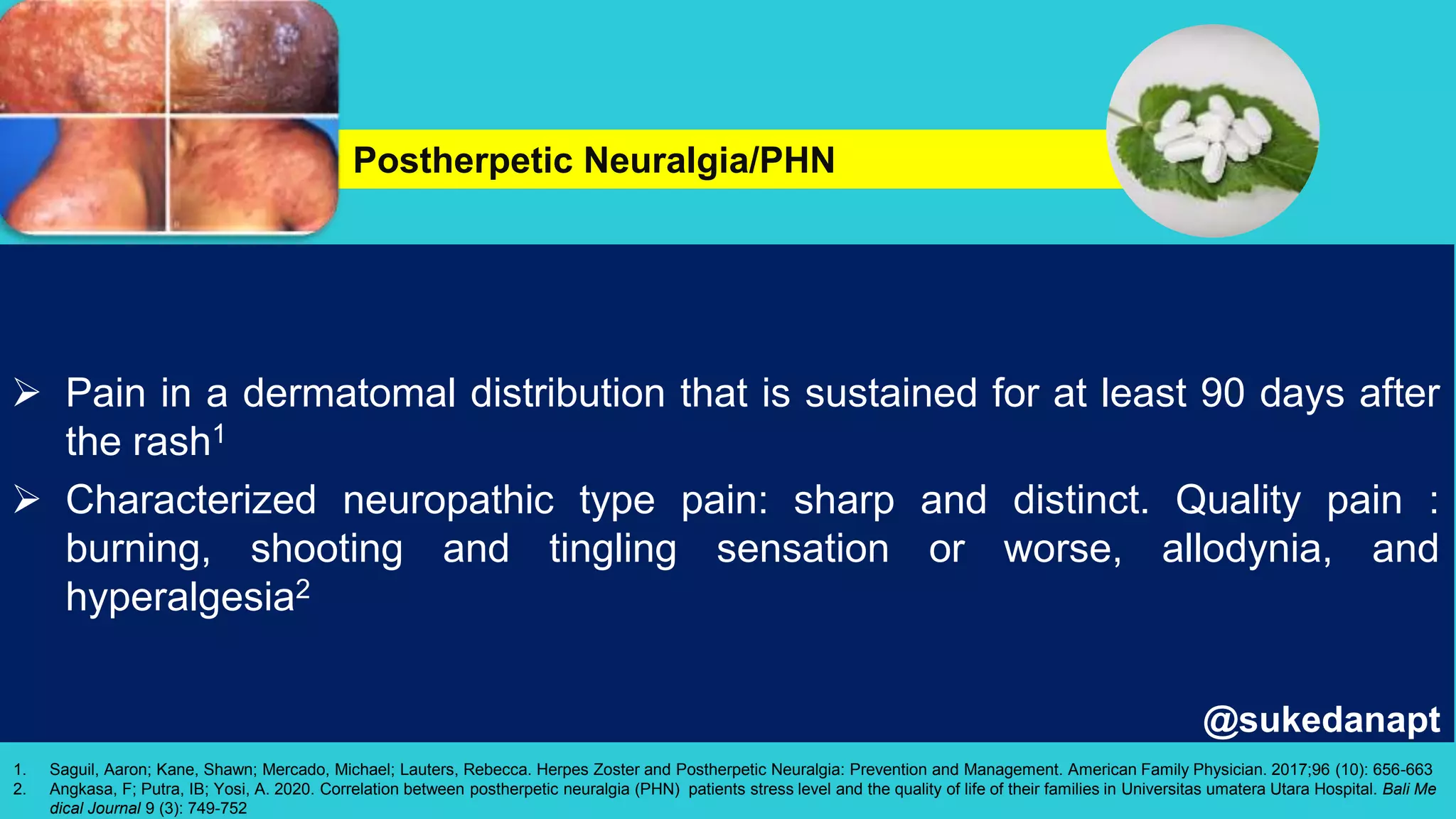 Postherpetic Neuralgia.pptx