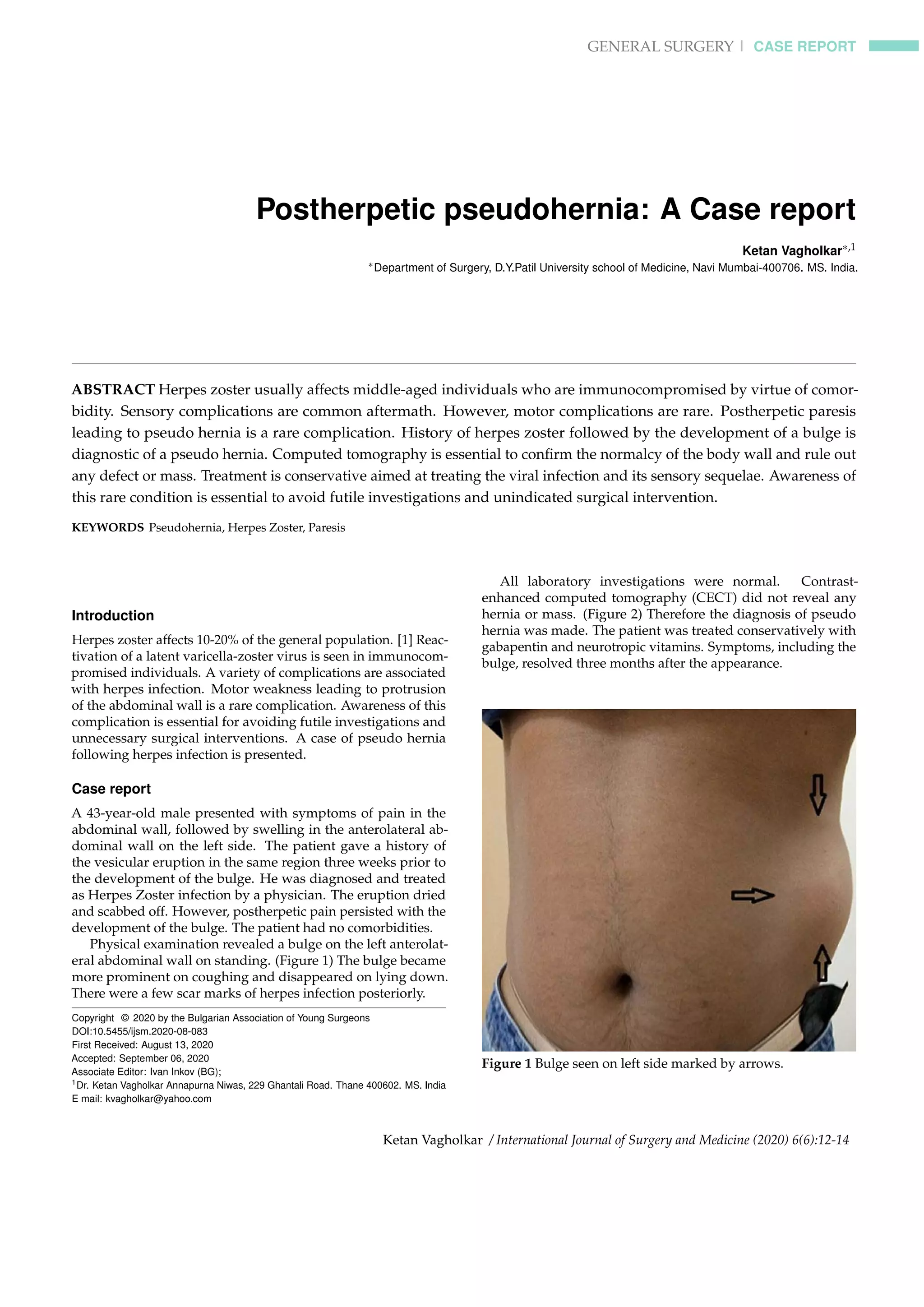 Postherpetic pseudohernia: Acase report. | PDF