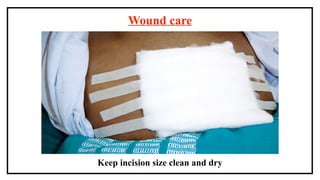 post hysterectomy care ppt from the nurses point of view | PPTX