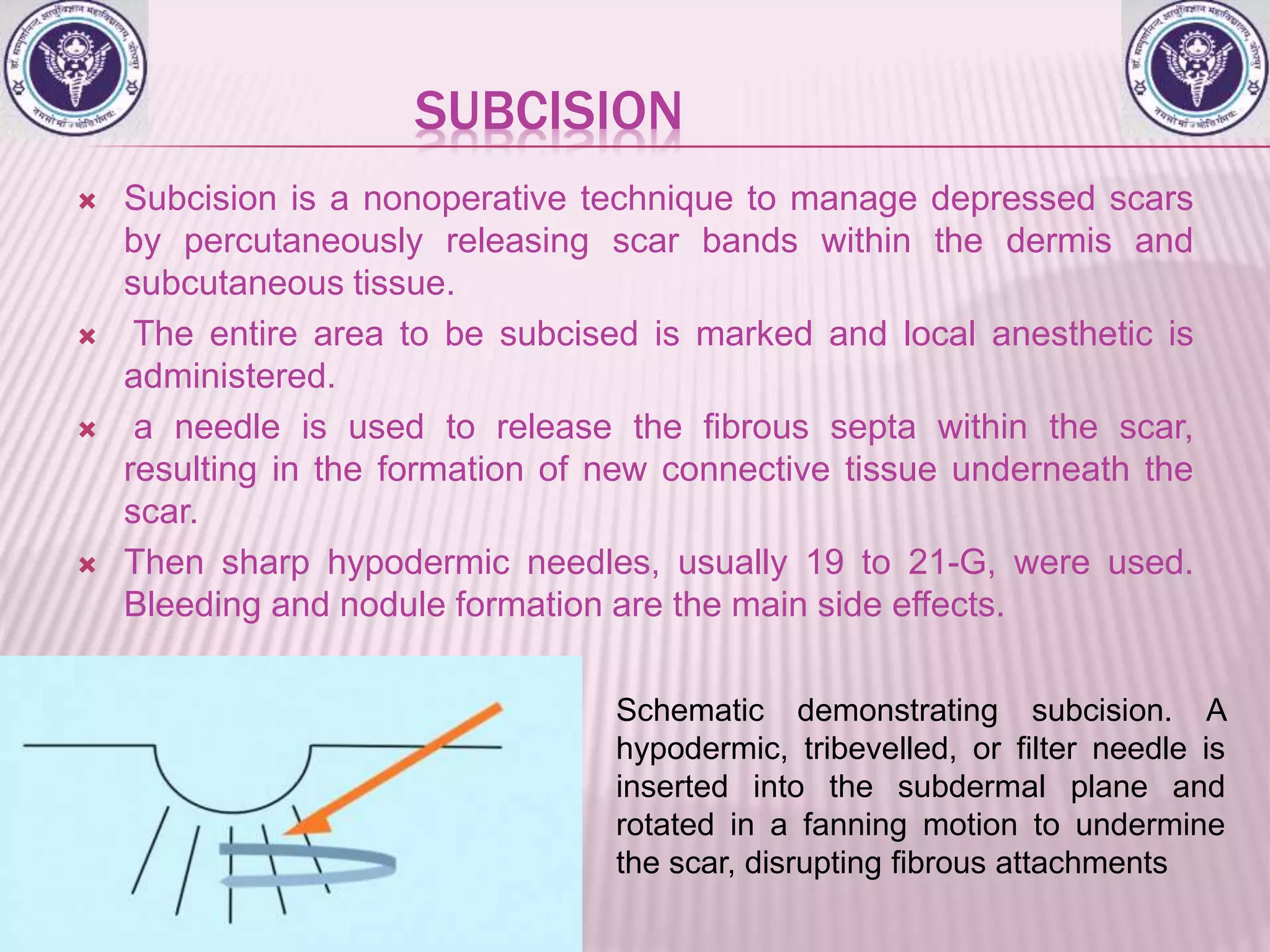 Acne scar presentation | PPTX