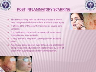 Acne scar presentation | PPTX