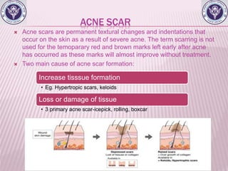 Acne scar presentation | PPTX