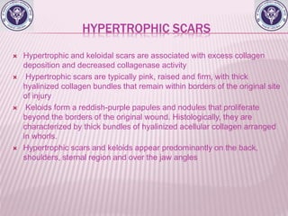 Acne scar presentation | PPTX