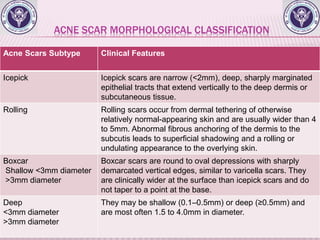 Acne scar presentation | PPTX
