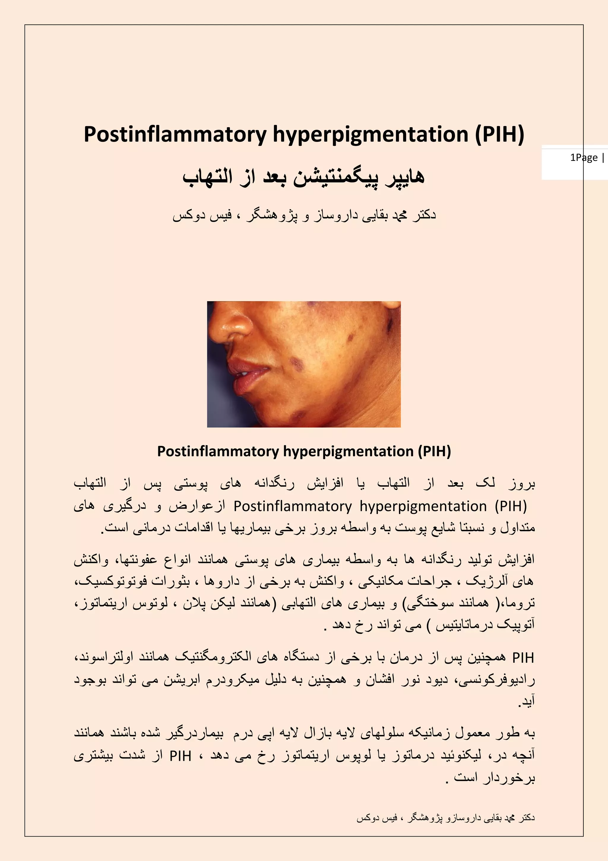 Postinflammatory hyperpigmentation,by Dr Mohammad Baghaei | PDF