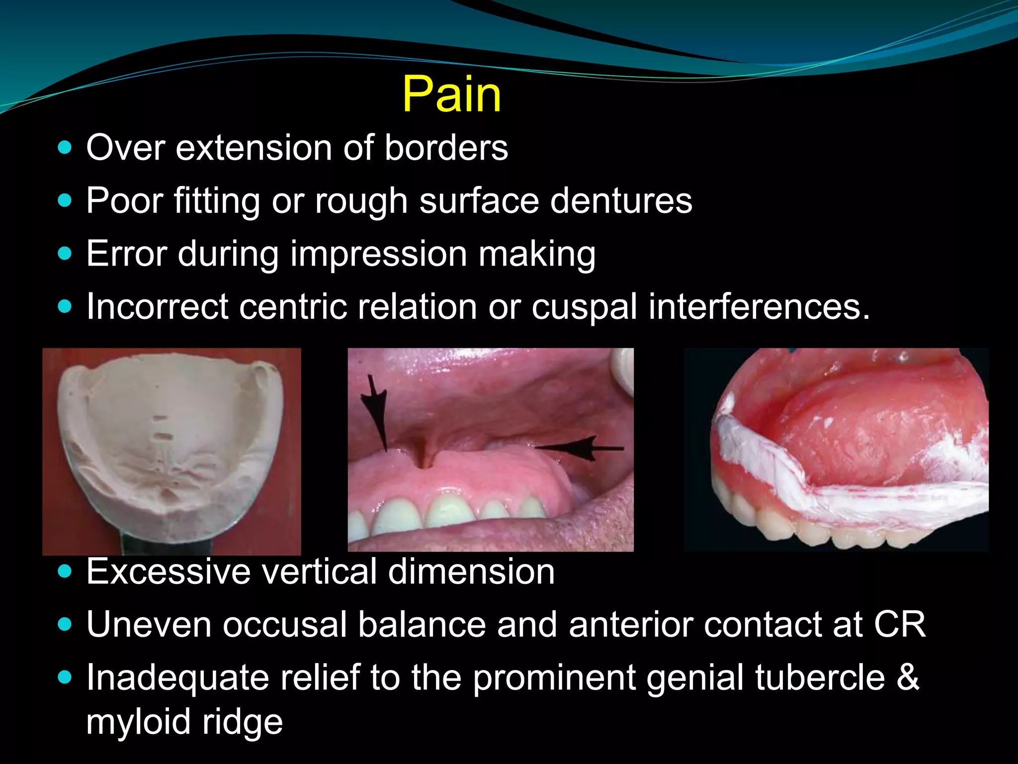 Post insertion complaints in complete dentures | PPTX