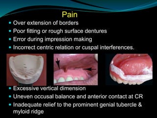 Post insertion complaints in complete dentures | PPTX