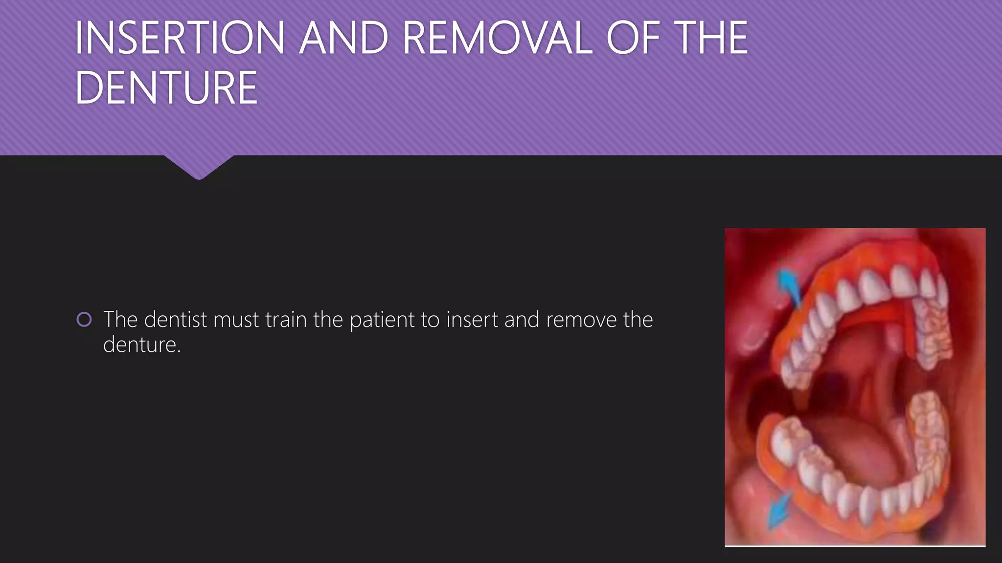 Post insertion instructions in complete denture patients | PPTX