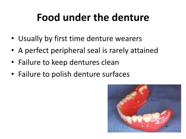 Post insertion problems in complete dentures | PPTX | Dental Health | Diseases and Conditions