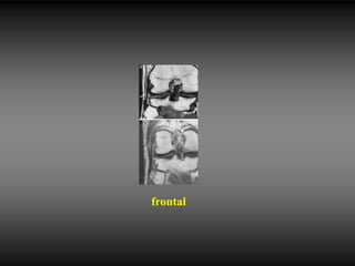 Anatomical Postion and plane (Biomechanics) | PPT