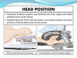 Postioning in Cranial Surgery | PPTX