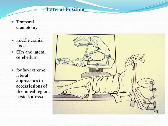 Postioning in Cranial Surgery | PPTX | Death, Injury, or Military ...