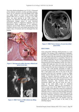 Post-laparoscopic cholecystectomy pancreatitis | PDF