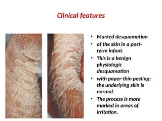 Postmaturity: Birth after 42 weeks gestation, | PPTX