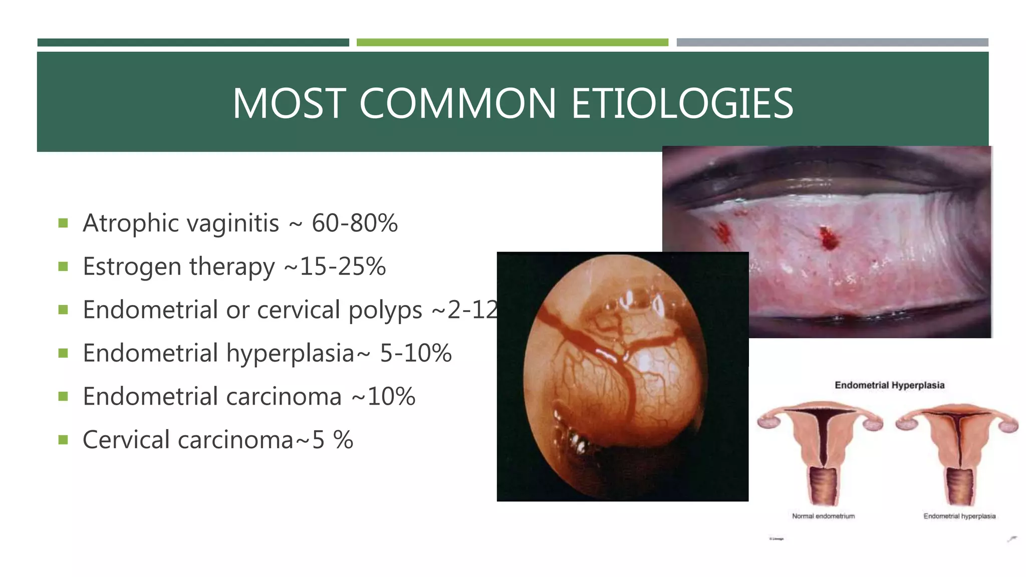 Postmenopausal bleeding | PPTX