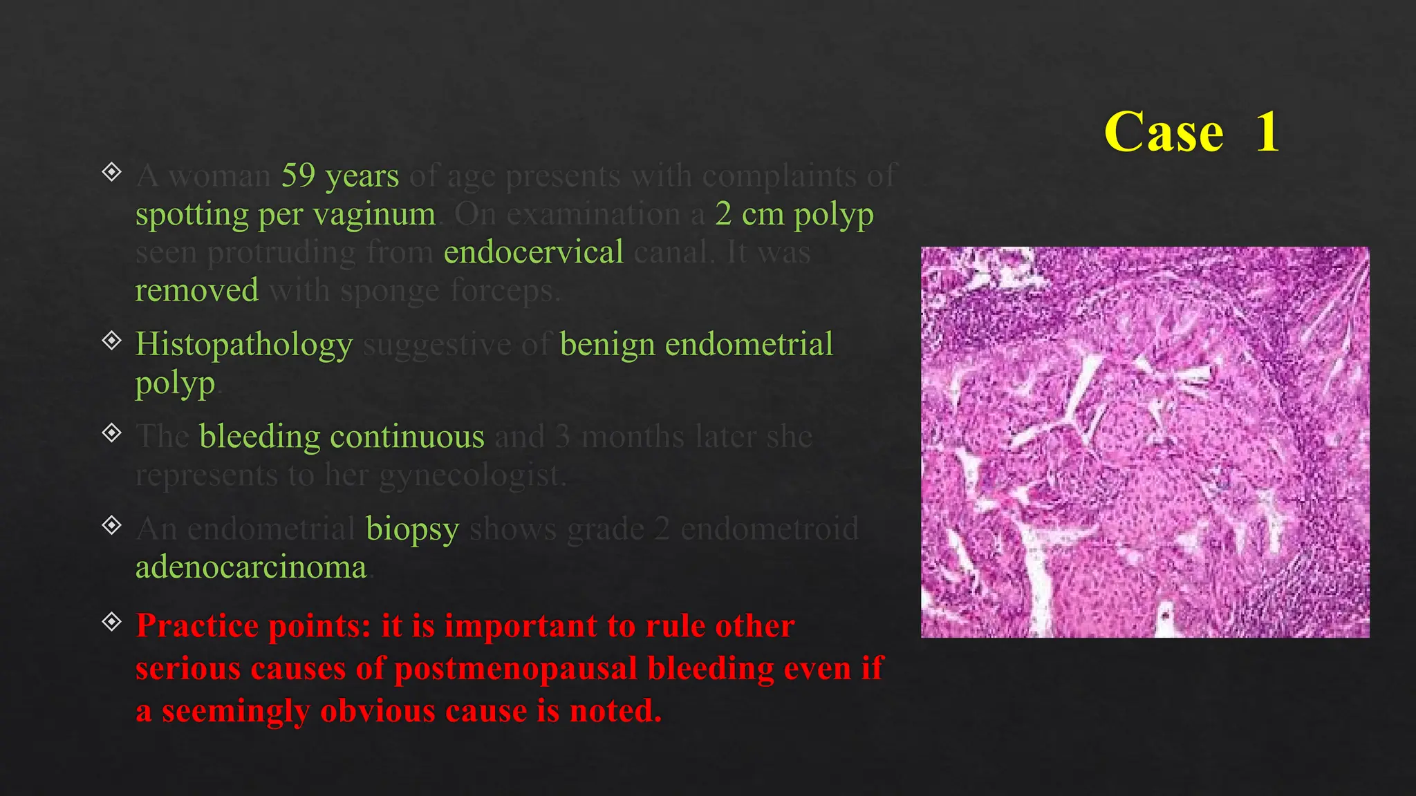 postmenopausal vaginal bleeding approach.pptx