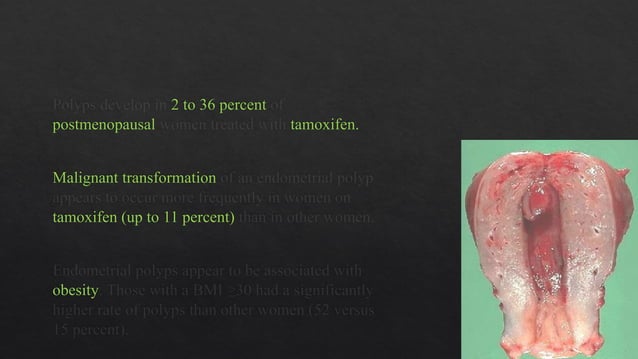postmenopausal vaginal bleeding approach.pptx | Menopause | Endocrine ...
