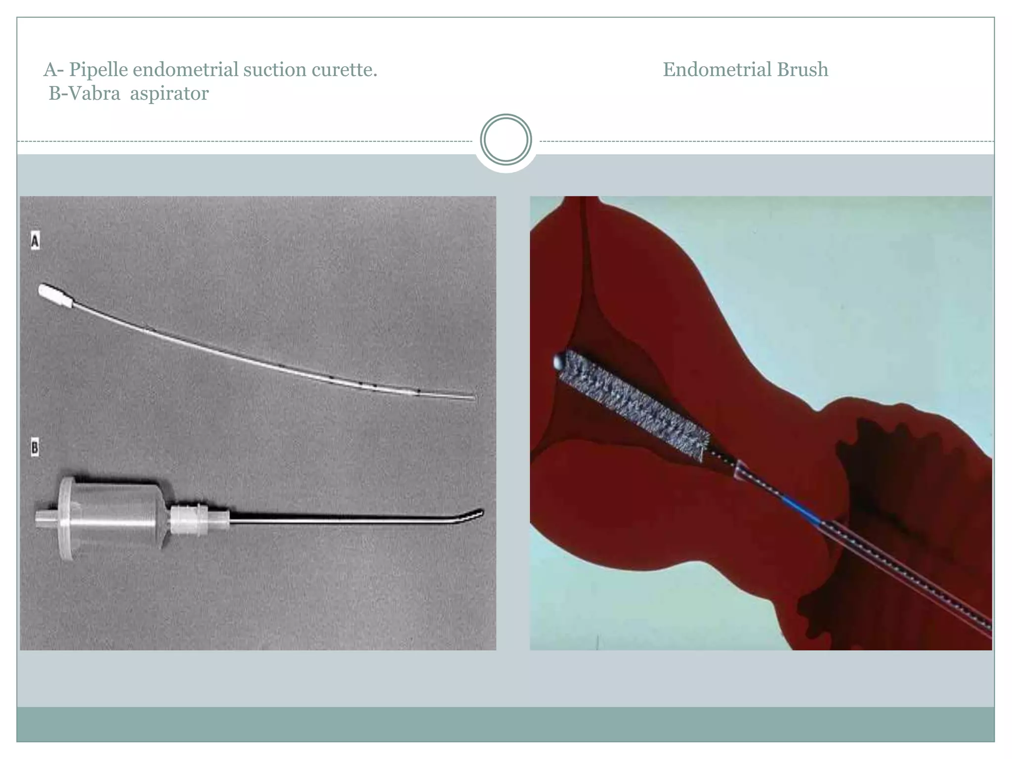 Post menopausal bleeding seminar | PPTX