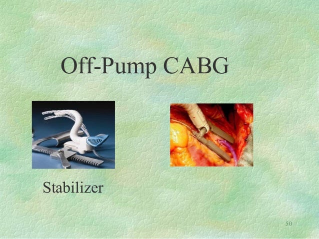 Post mi and cabg.2012.2013