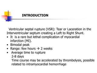 Post MI Ventricular Septal Rupture | PPT