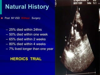 Post Myocardial infarction vsd repair by infarct exclusion technique | PPT