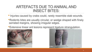 POST MORTEM ARTEFACTS(forensic medicine) | PPTX