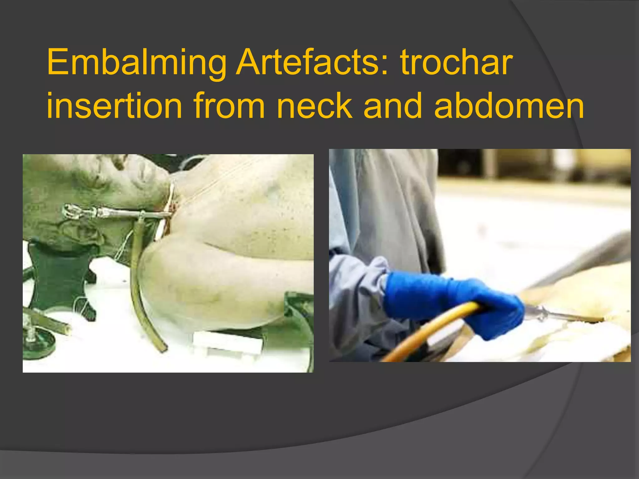 Postmortem artifacts - a Forensic perspective | PPTX