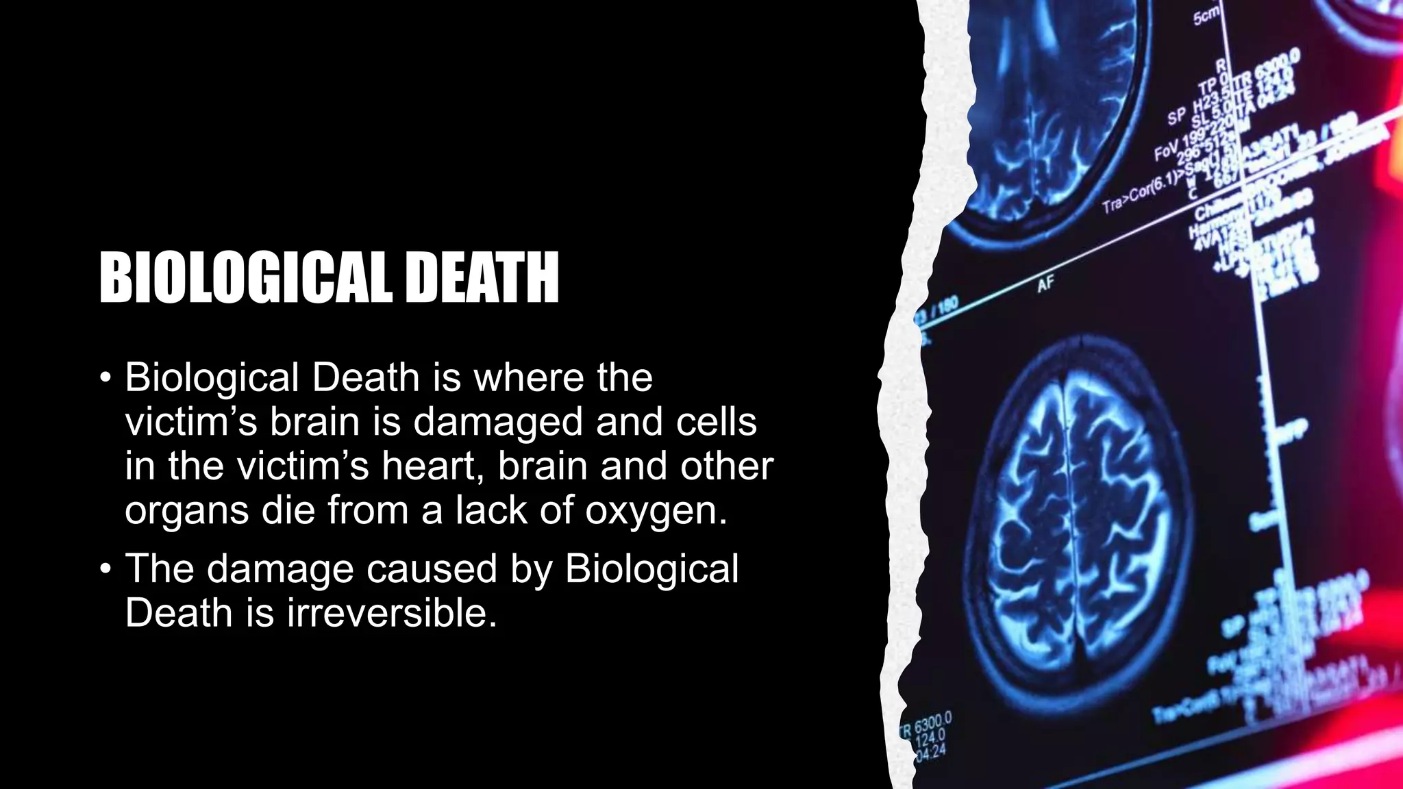 POST-MORTEM CARE | PPTX