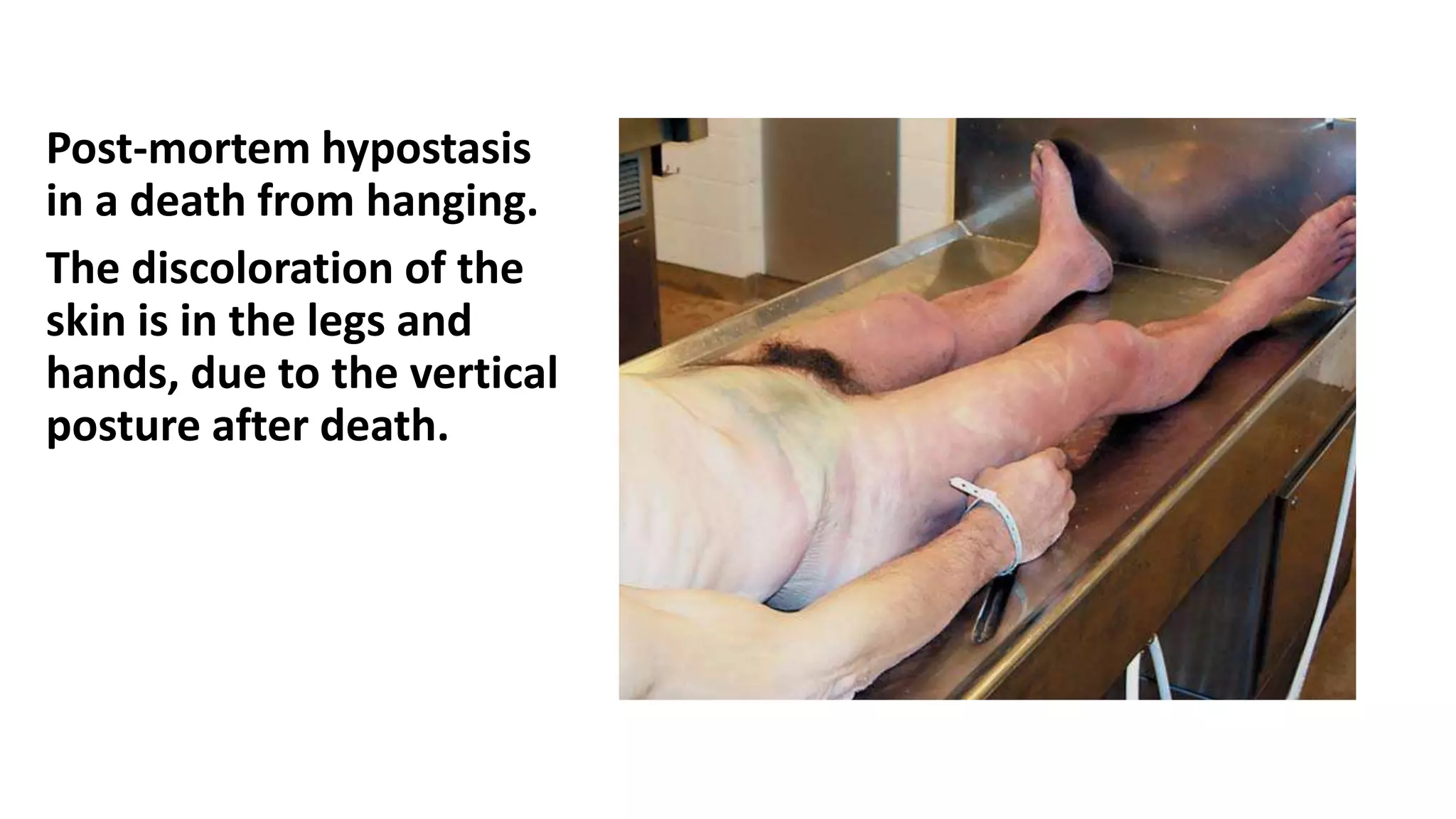 POST MORTEM CHANGES.pptx