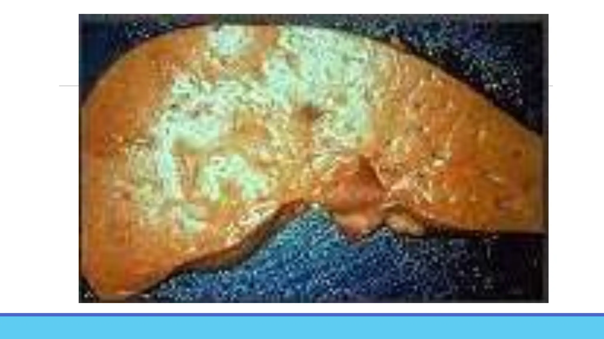 Post Mortem Changes in Forensic Medicine.new.pptx