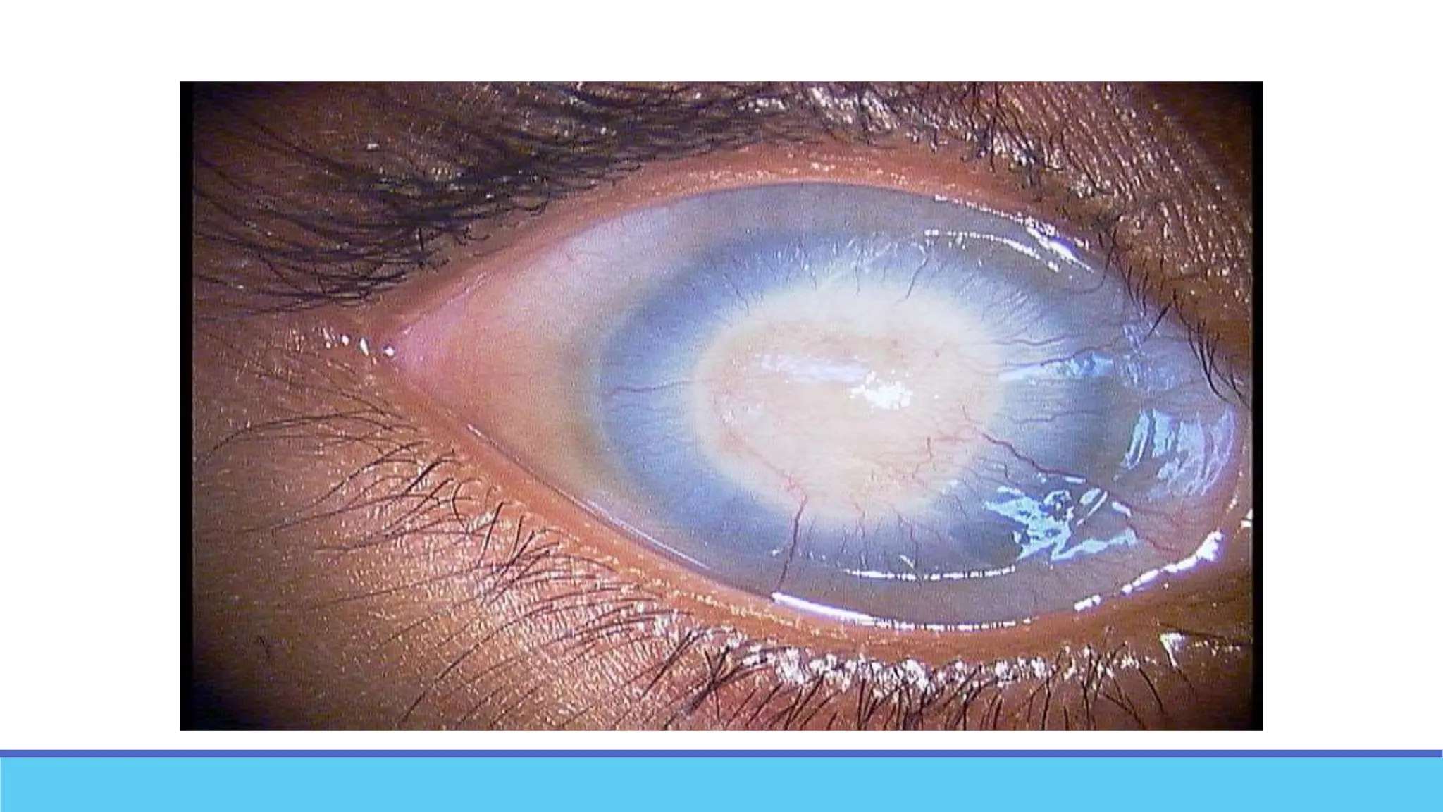 Post Mortem Changes in Forensic Medicine.new.pptx