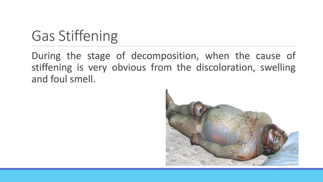 Post Mortem Changes in Forensic Medicine.new.pptx