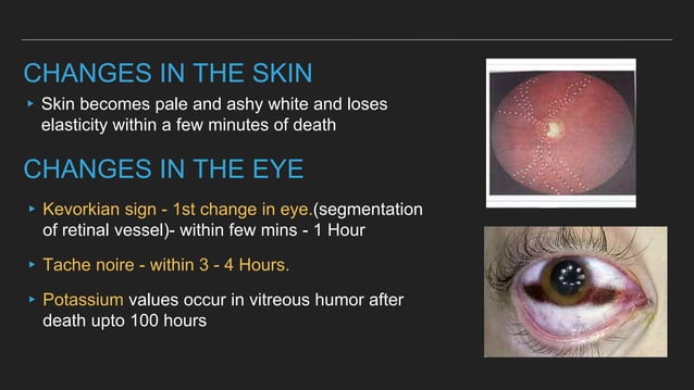 Postmortem changes .pptx