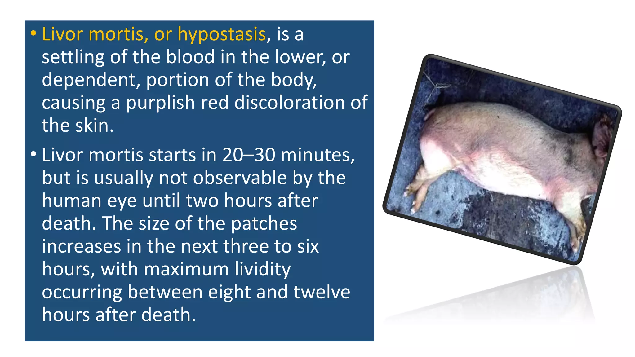 Death and Postmortem Changes | PDF