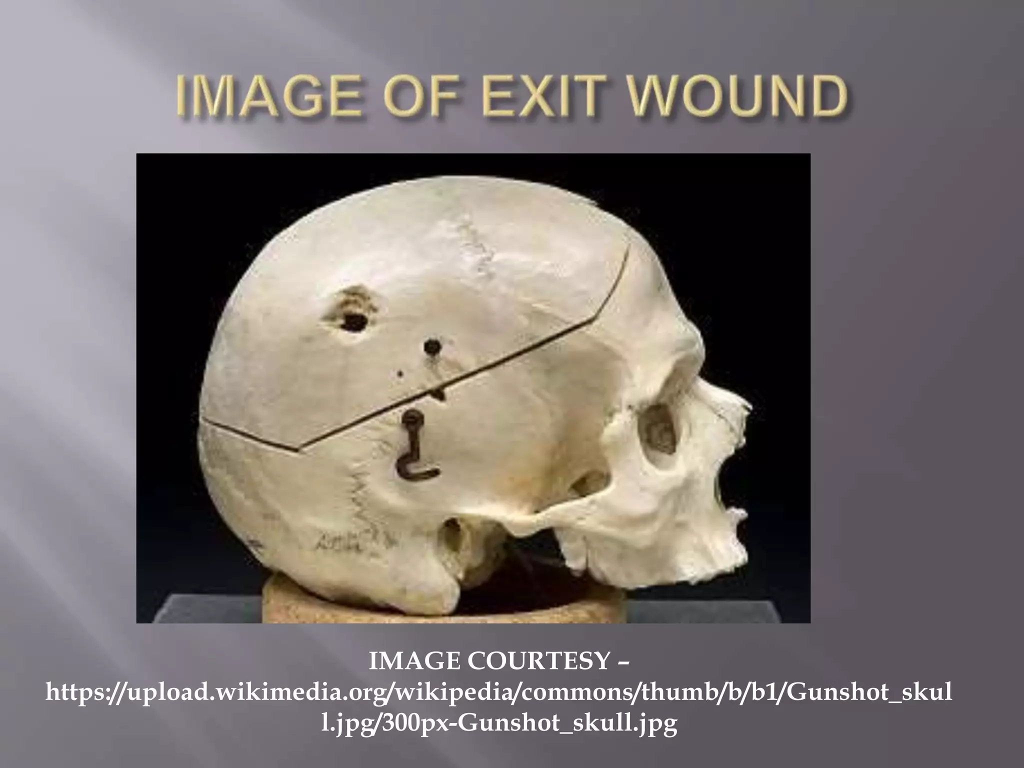 Post-Mortem Examintion of Gun-Shot Wounds by Souvik Dhar | PPTX