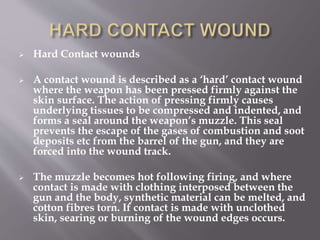 Post-Mortem Examintion of Gun-Shot Wounds by Souvik Dhar | PPTX | Arms ...