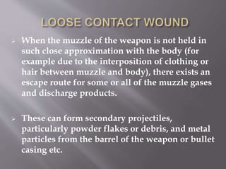 Post-Mortem Examintion of Gun-Shot Wounds by Souvik Dhar | PPTX | Arms ...