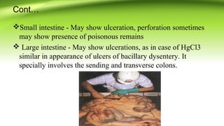 Post mortem finding | PPT